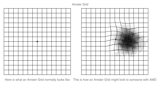 Macular Degeneration Gifts Expanded Amsler Grid Chart Set - 7 Vision ...