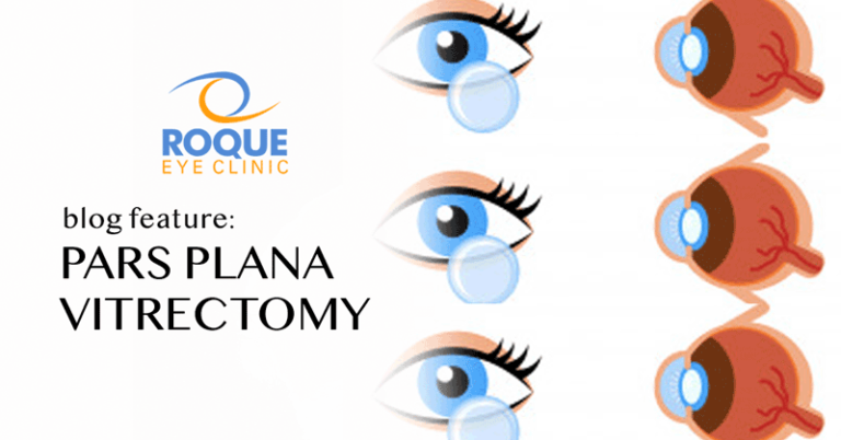 Pars Plana Vitrectomy - ROQUE Eye Clinic | Eye.com.ph