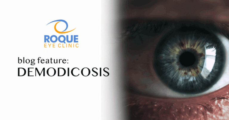 Demodicosis - ROQUE Eye Clinic | Eye.com.ph Blog