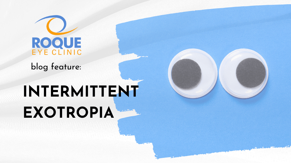 Intermittent Exotropia - ROQUE Eye Clinic | Eye.com.ph