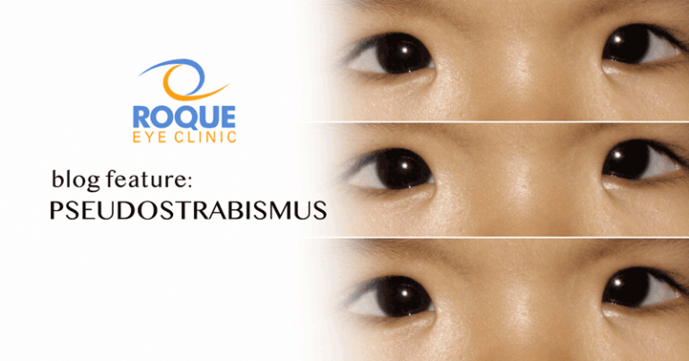 Instructions After Strabismus Surgery - ROQUE Eye Clinic | Eye.com.ph