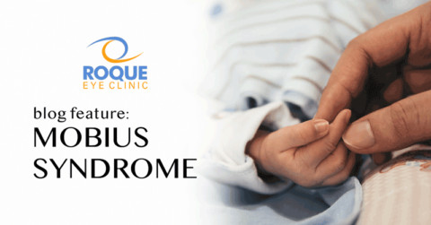 Mobius Syndrome - ROQUE Eye Clinic | Eye.com.ph
