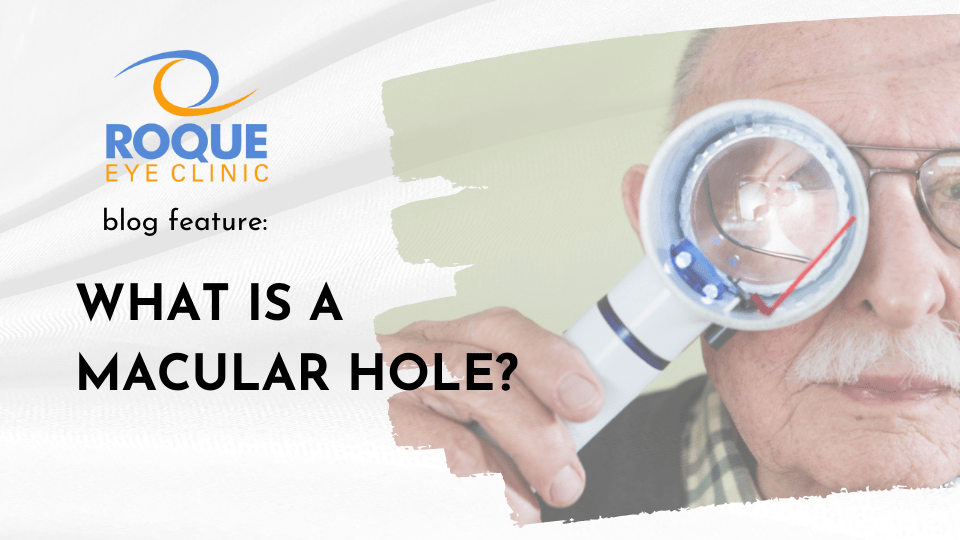 Macular Hole - ROQUE Eye Clinic | Eye.com.ph