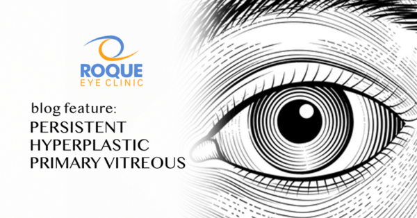 Persistent Hyperplastic Primary Vitreous - PHPV - ROQUE Eye Clinic ...