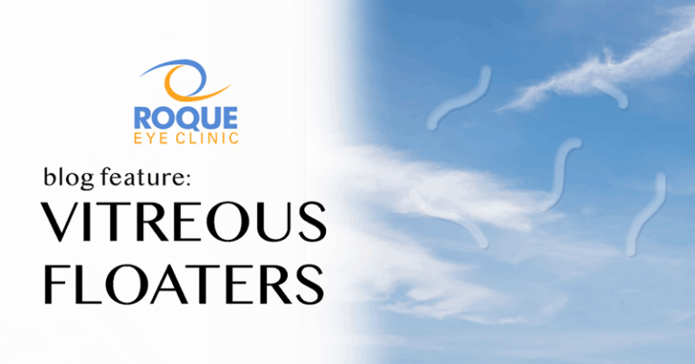 Vitreous Floaters - ROQUE Eye Clinic | Eye.com.ph