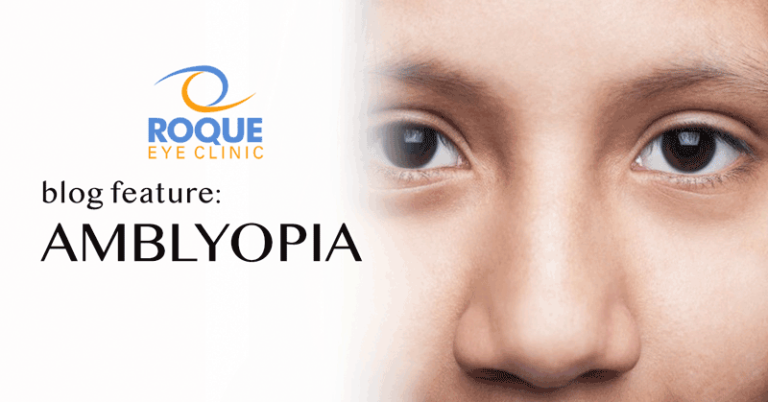 Amblyopia | Roque Eye Clinic