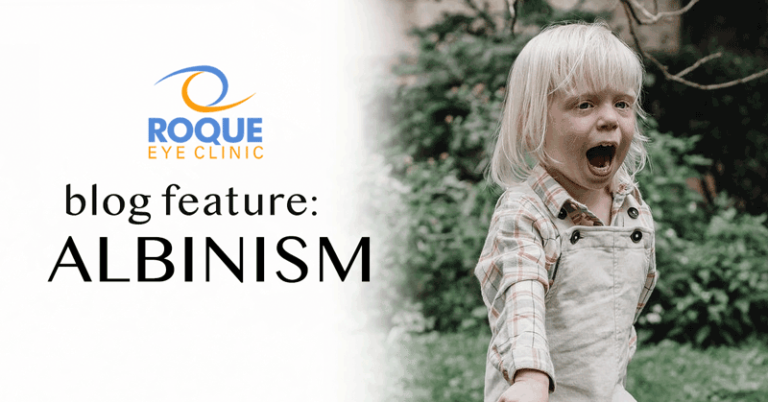Albinism | Oculocutaneous Albinism & Ocular Albinism | Roque Eye Clinic