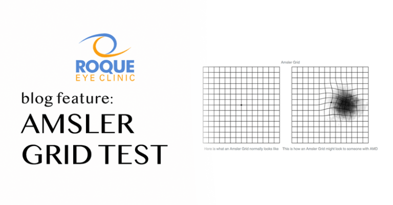 Amsler Grid Test | Roque Eye Clinic