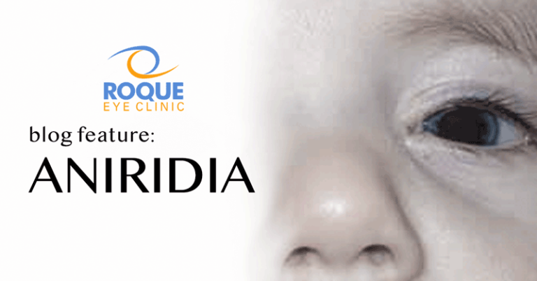 Aniridia (Absence of an Iris) | Roque Eye Clinic