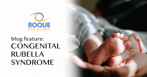 Congenital Rubella Syndrome - ROQUE Eye Clinic | Eye.com.ph