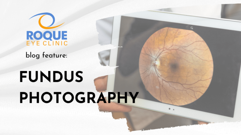 Fundus Photography - ROQUE Eye Clinic | Eye.com.ph