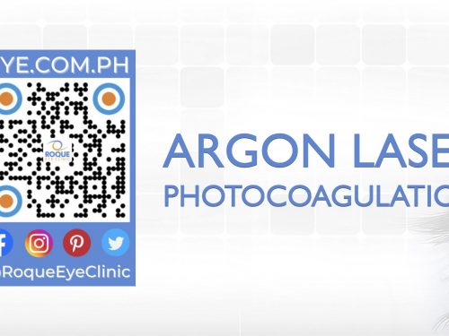 LASER SURGERY | ARGON | EXCIMER | FEMTOSECOND | YAG