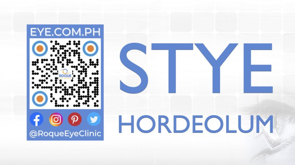Stye or Hordeolum - ROQUE Eye Clinic | Eye.com.ph