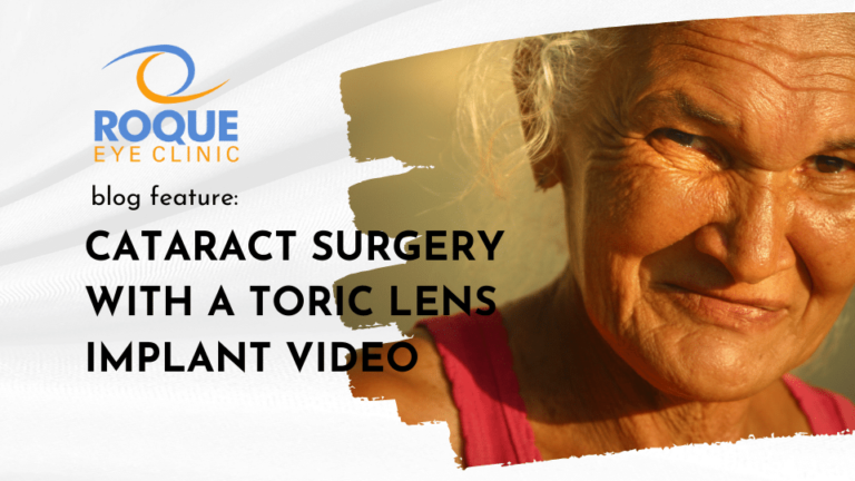 Cataract Surgery with a Toric Lens Implant Video - ROQUE Eye Clinic ...