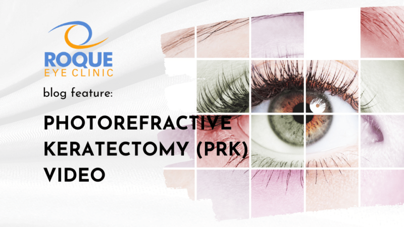 Photorefractive Keratectomy (PRK) Video | ROQUE Eye Clinic