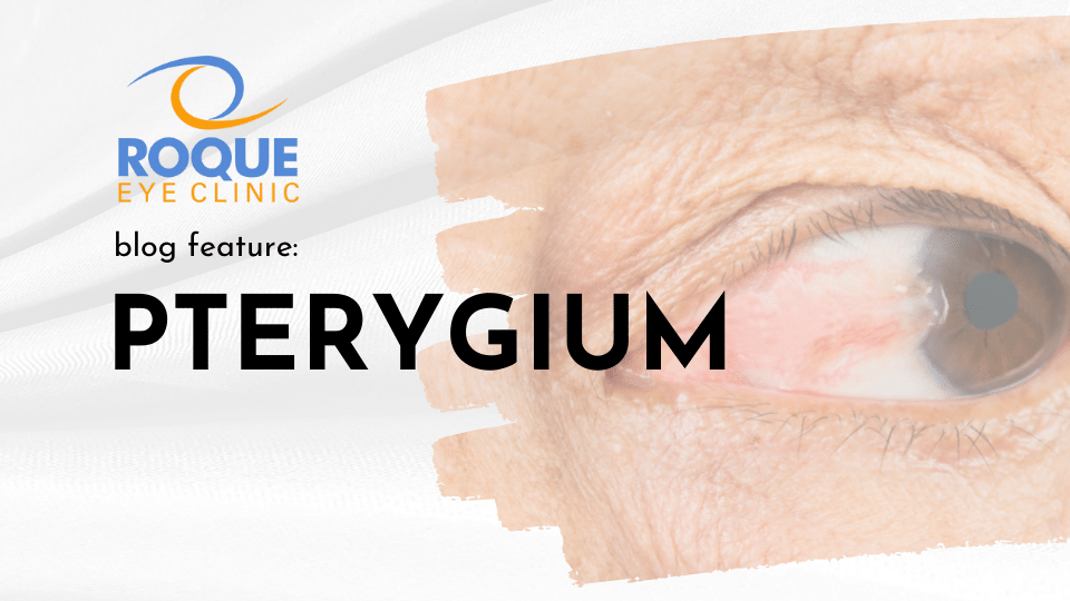 Pterygium - ROQUE Eye Clinic | Eye.com.ph | Manila, Philippines