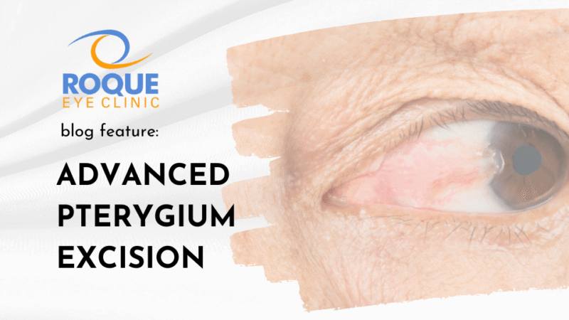 Advanced Pterygium Excision - ROQUE Eye Clinic | Eye.com.ph