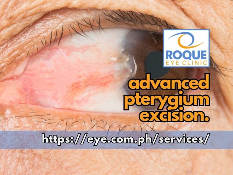 Aflibercept (EYLEA) Anti-VEGF Intravitreal Injection