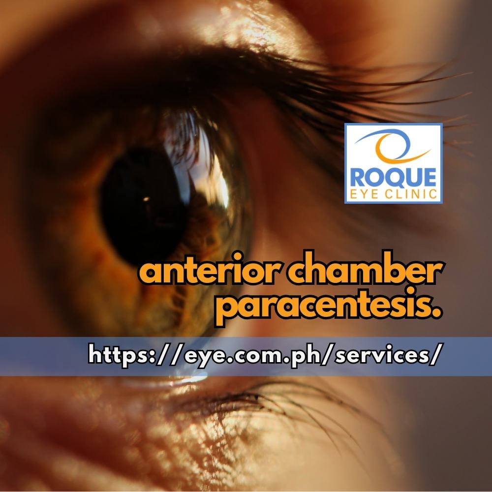 Anterior Chamber Paracentesis - ROQUE Eye Clinic | Eye.com.ph