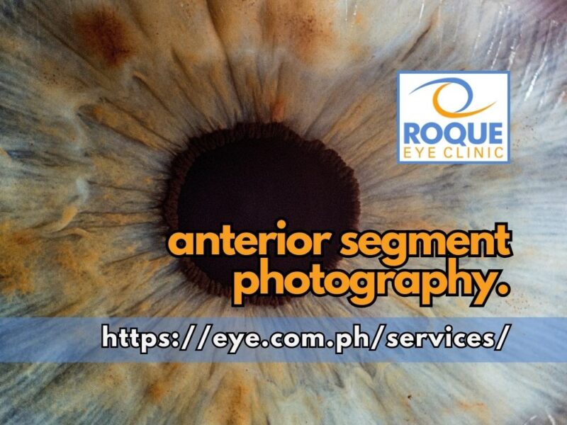 EYE CARE SERVICE & PRICES | ROQUE Eye Clinic