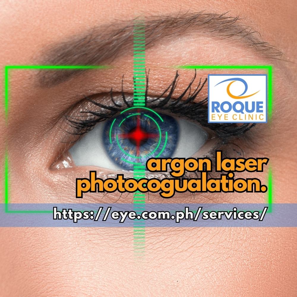 ARGON Laser Photocoagulation - ROQUE Eye Clinic | Eye.com.ph
