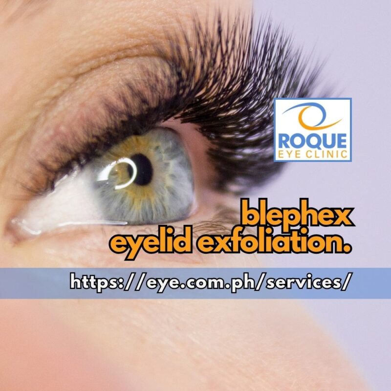 Blephex Eyelid Exfoliation - ROQUE Eye Clinic | Eye.com.ph