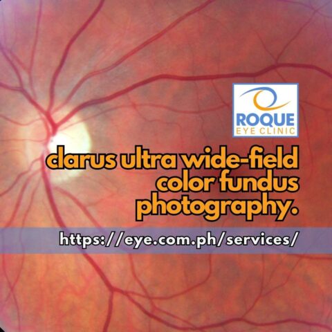 CLARUS Ultra Wide-Field Color Fundus Photos - | Eye.com.ph