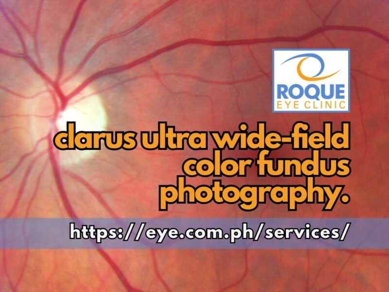 DIAGNOSTICS | Biometry | Microscopy | Topography | Angiography