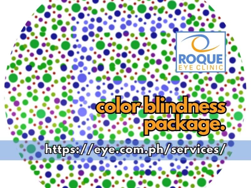 EYE CARE SERVICE & PRICES | ROQUE Eye Clinic