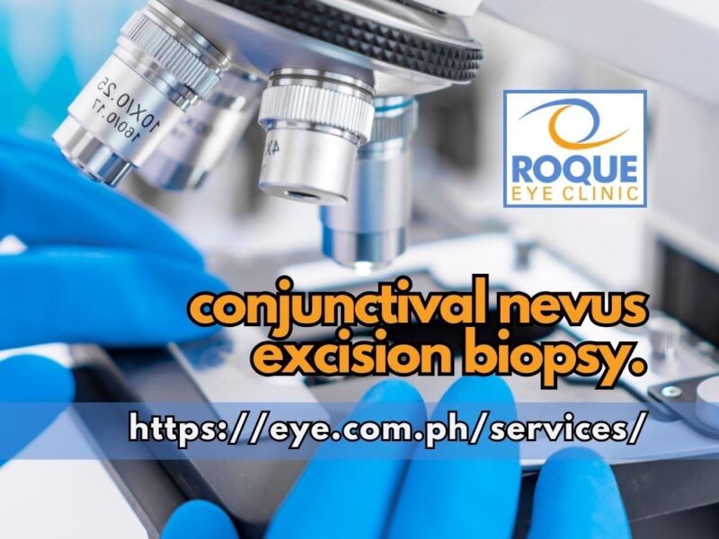 Phacoemulsification Cataract Surgery - PREMIUM - ROQUE Eye Clinic | Eye ...