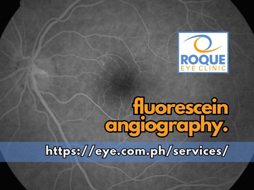 fluorescein angiography Archives - ROQUE Eye Clinic | Eye.com.ph