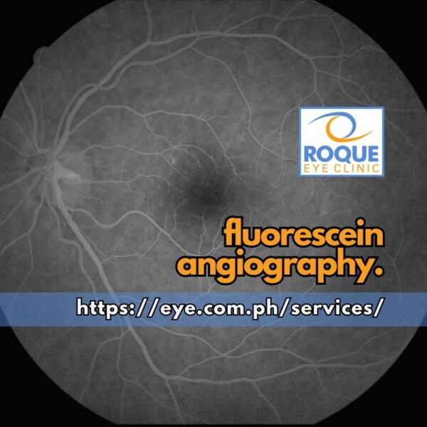 Fluorescein Angiography - ROQUE Eye Clinic | Eye.com.ph