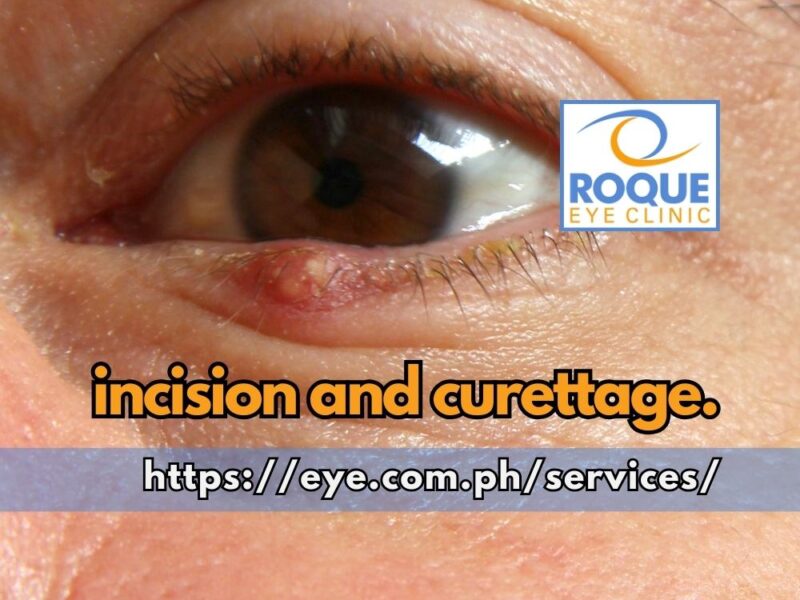 EYE SURGERY | Phacoemulsification | FLACS | Transplantation