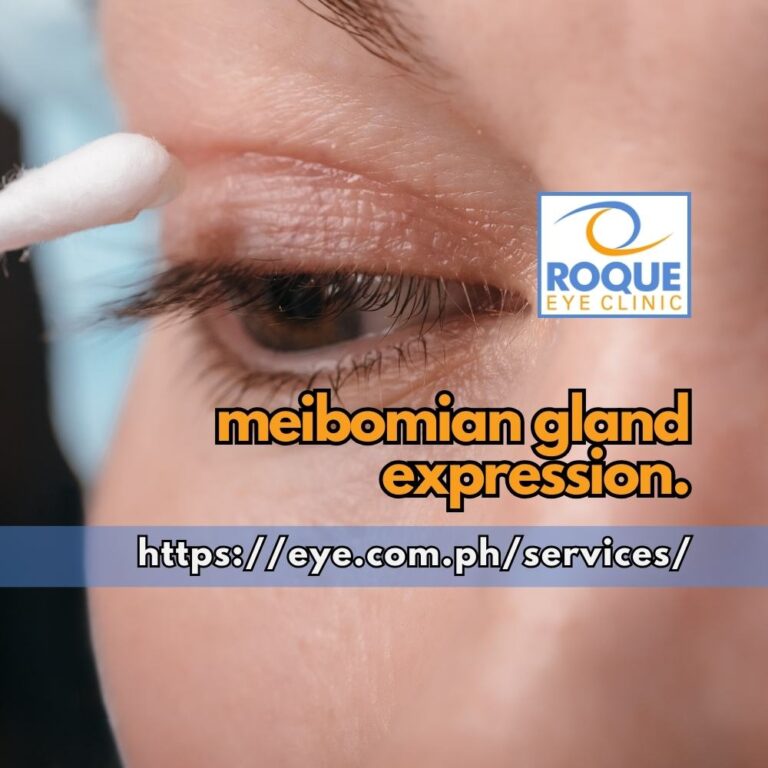 Eye Care Services and Prices - ROQUE Eye Clinic | Eye.com.ph