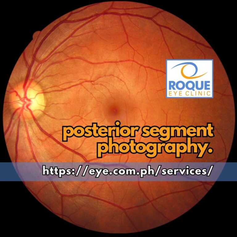 Posterior Segment Photography - ROQUE Eye Clinic | Eye.com.ph