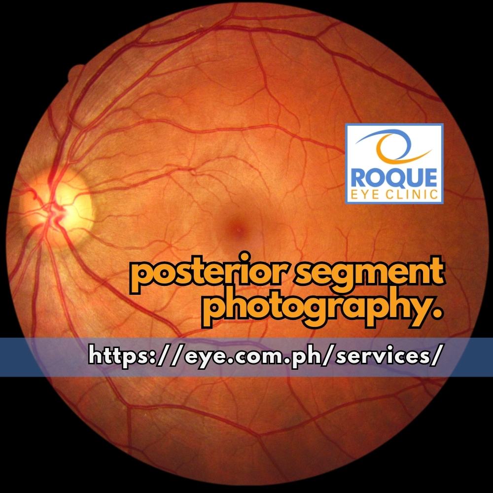 Posterior Segment Photography - ROQUE Eye Clinic | Eye.com.ph