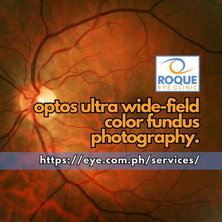 OPTOS Ultra Wide-Field Color Fundus Photos - | Eye.com.ph