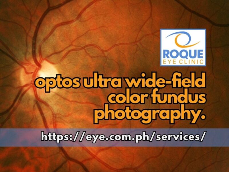Glaucoma Risk Assessment Package - ROQUE Eye Clinic | Eye.com.ph