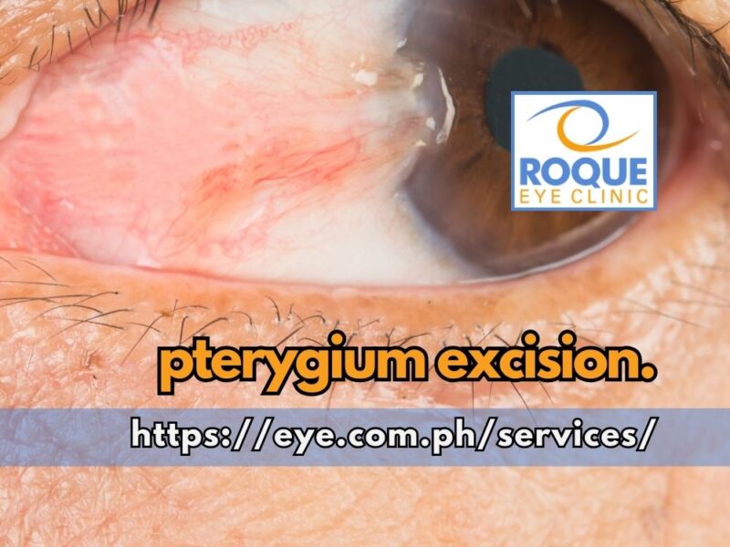 Phacoemulsification Cataract Surgery - PREMIUM - ROQUE Eye Clinic | Eye ...
