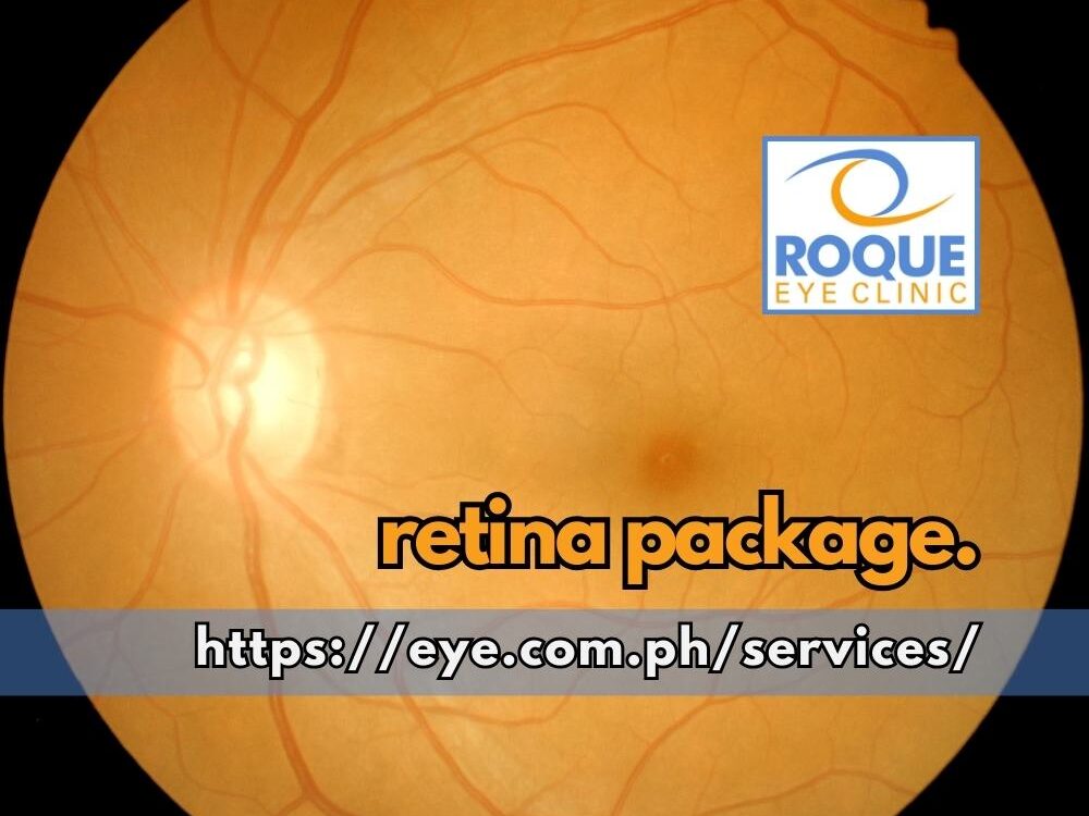 Glaucoma Risk Assessment Package - ROQUE Eye Clinic | Eye.com.ph