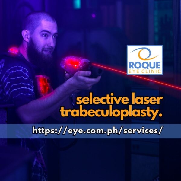 Selective Laser Trabeculoplasty - ROQUE Eye Clinic | Eye.com.ph