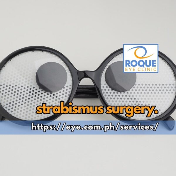 Strabismus Surgery - ROQUE Eye Clinic | Eye.com.ph