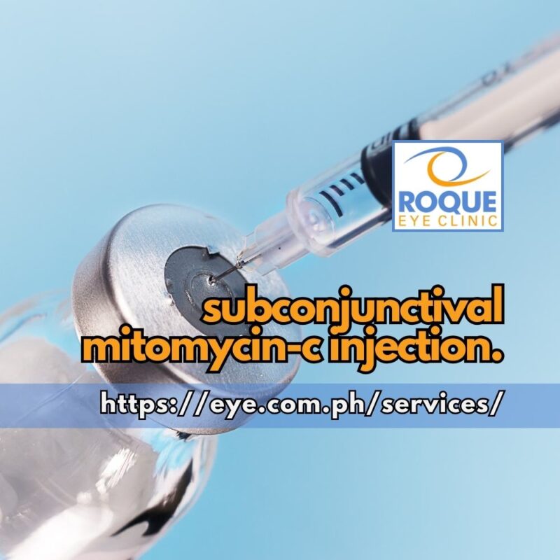 Subconjunctival Mitomycin Injection - ROQUE Eye Clinic | Eye.com.ph