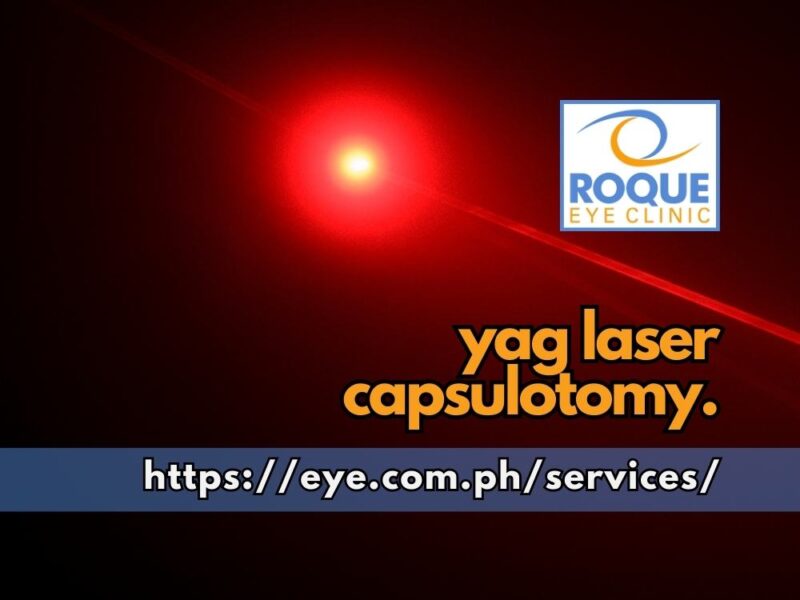 Conjunctival Nevus - Eye Freckle Laser Removal