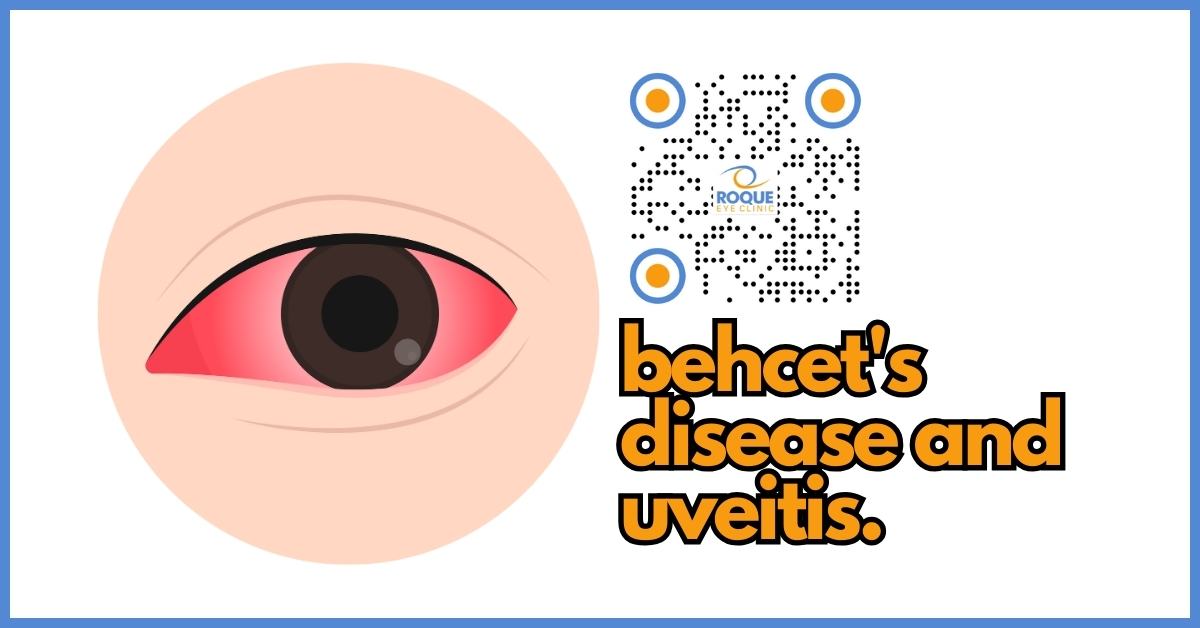 Adamantiades-Behcet's Disease and Uveitis: A Detailed Patient Guide