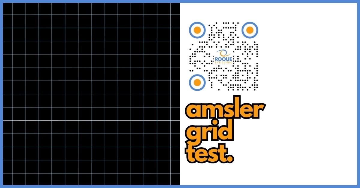 Comprehensive Guide to the Amsler Grid Test | Roque Eye Clinic