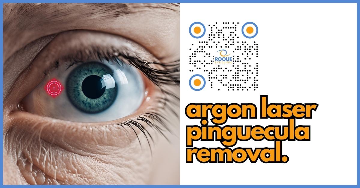 Effective Argon Laser Photocoagulation for Pinguecula: Comprehensive ...