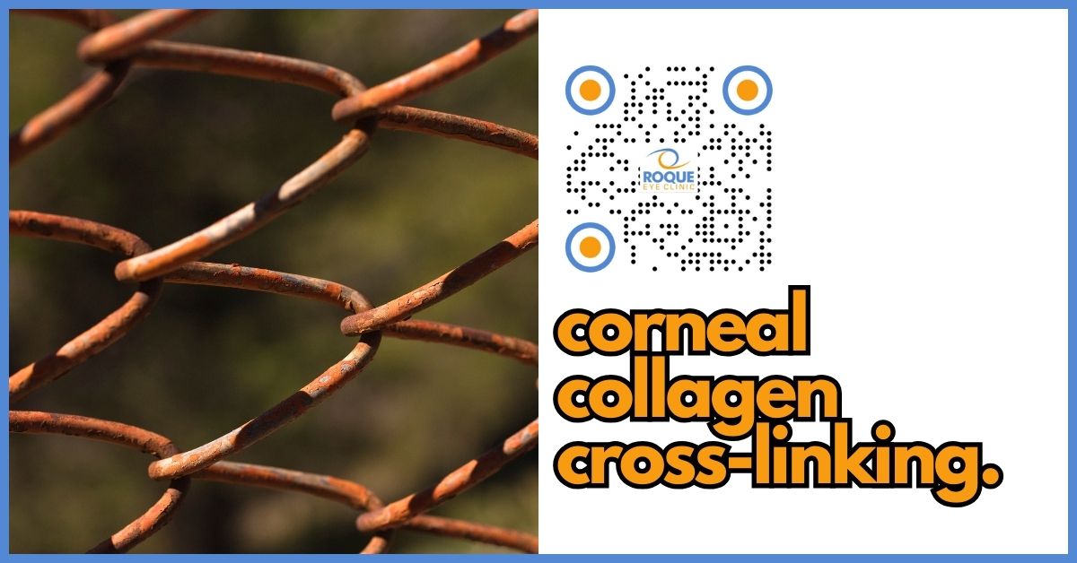 Corneal Collagen Cross-Linking in Manila: Treatment for Keratoconus ...