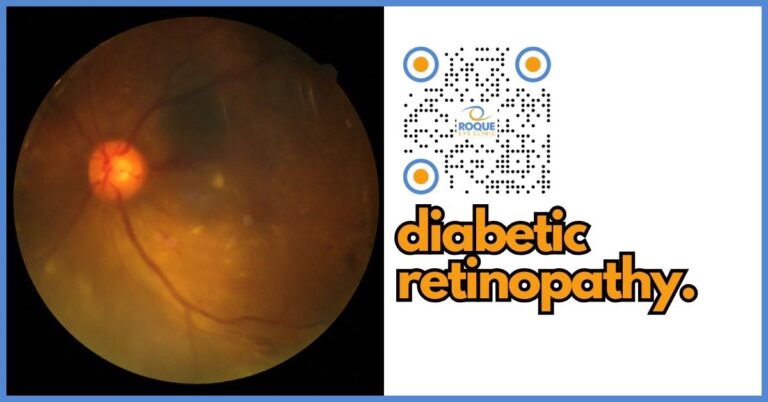 Pupil Dilation and Dilated Fundus Examination: A Comprehensive Guide