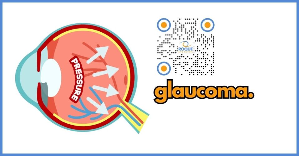 Capillary Hemangioma | Strawberry Nevus | Roque Eye Clinic